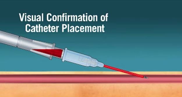 SurFlash® Polyurethane I.V. Catheters